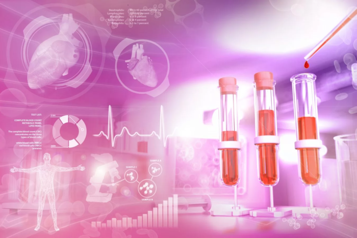 Număr scăzut de trombocite: cauze, remedii și alimente recomandate ...