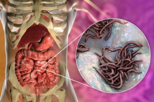 Alimente cu efect antiparazitar: scapă natural de viermii intestinali ...