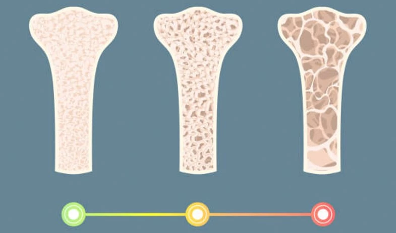 Planta biblică folosită pentru oase puternice. Ceaiul cu efecte ...
